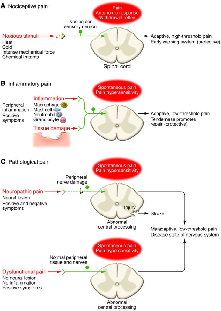 The Genetics of Pain: An Integrated Approach | Leaders in ...